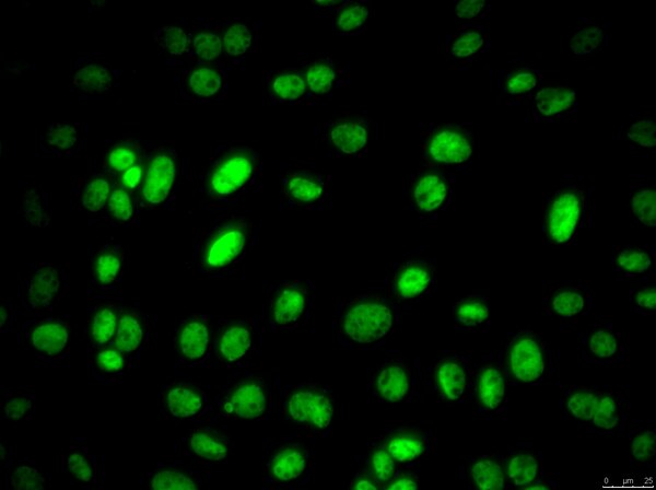 PyMT-1099 Mouse Mammary Tumor EMT Model Cell Line | SCC422